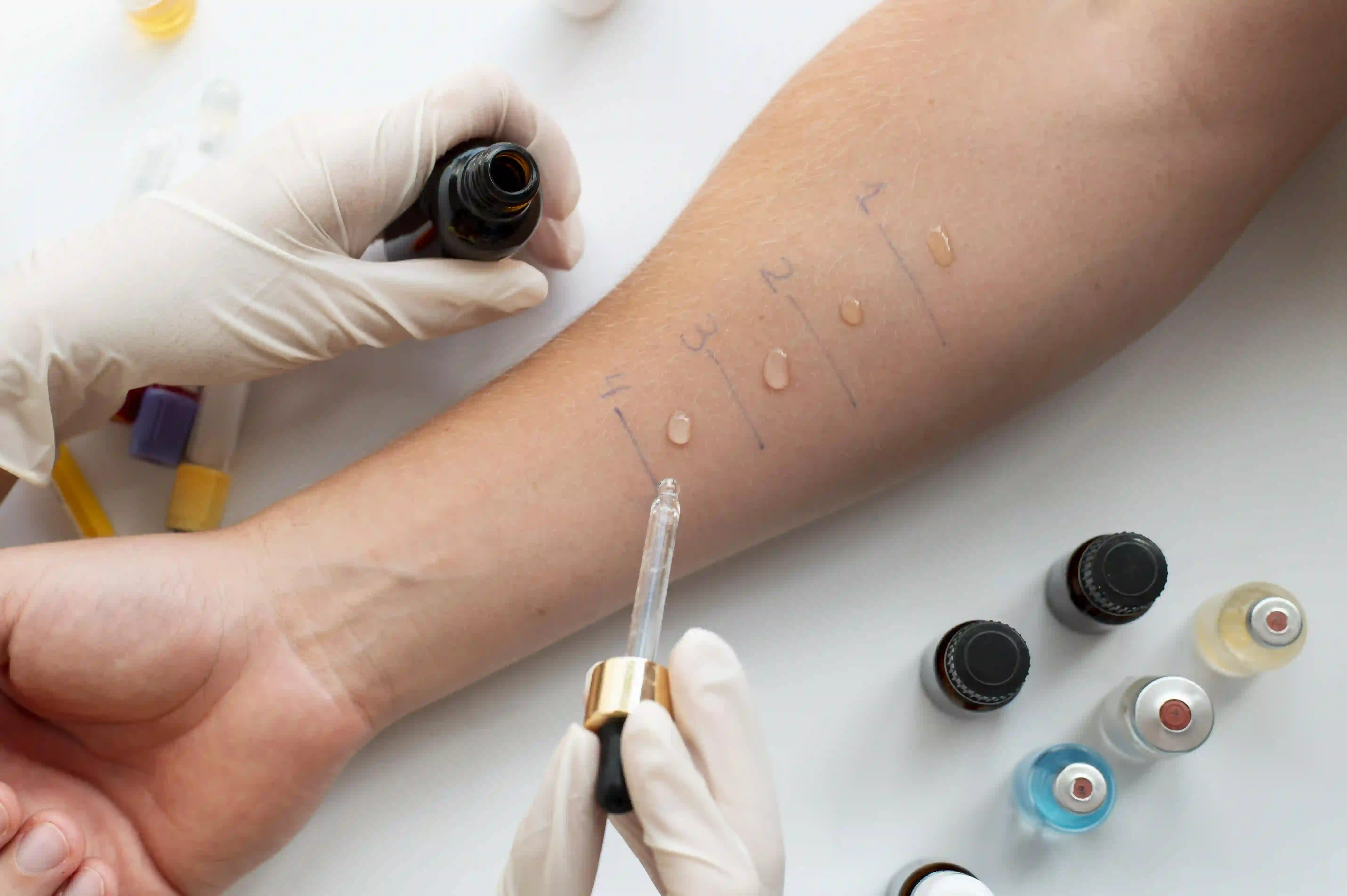 Food Allergy and Sensitivity Testing - Modern Growth Medicine